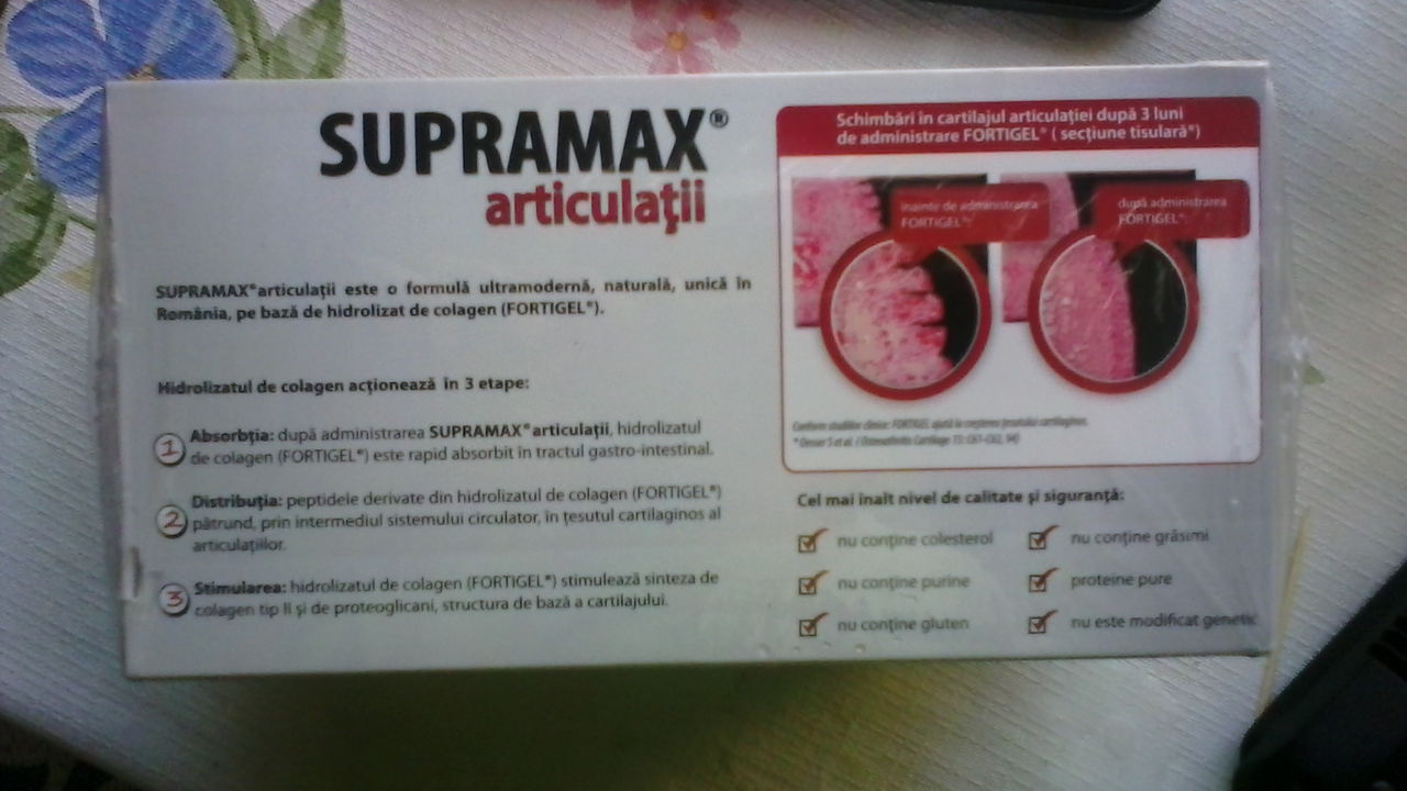 supramax articulatii