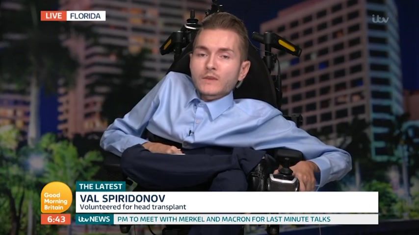 Play.md - Мужчина отказался от пересадки головы из‐за красивой жены