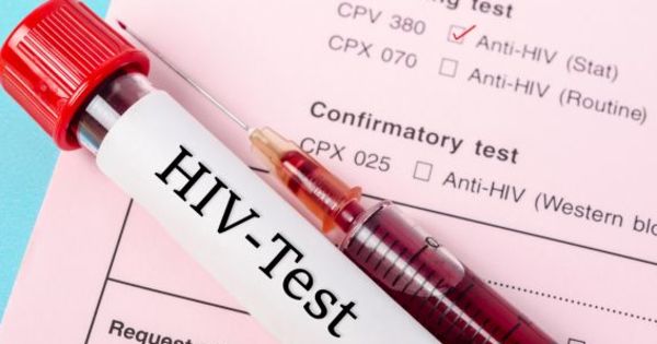 Studiu: Republica Moldova a făcut câțiva pași înapoi privind HIV/SIDA