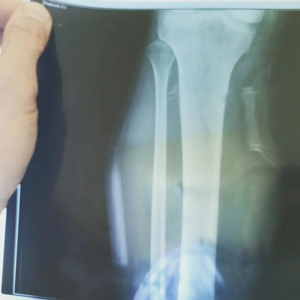 Bărbatul care a vandalizat Ambasada Rusiei la Chișinău, rănit pe front